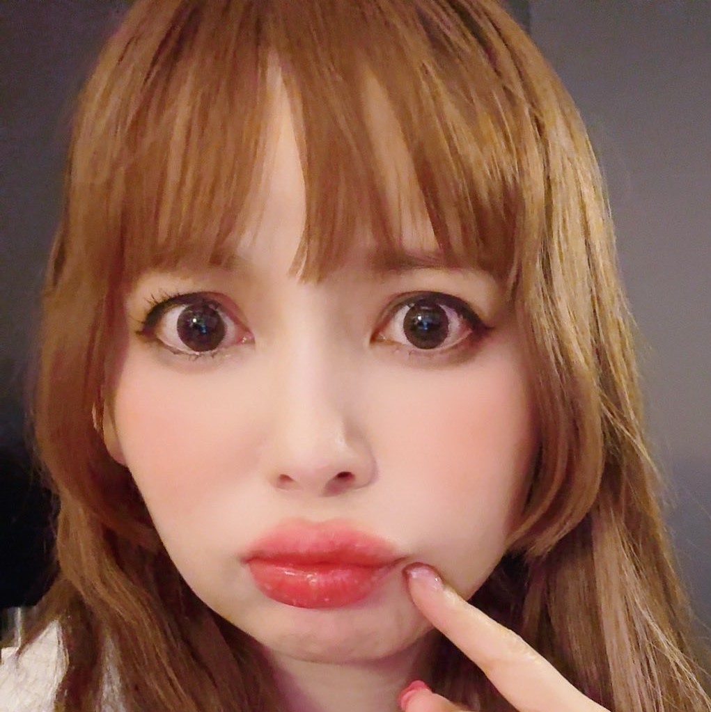 中川翔子「くちびる5倍になった」ひどいアレルギー症状から一夜明け、近影を投稿し話題に(西スポWEB OTTO！) | JMMAポータル